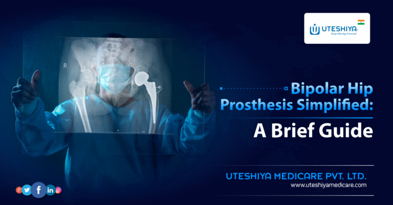 Bipolar Hip Prosthesis Simplified: A Brief Guide - Orthopedic Implants ...