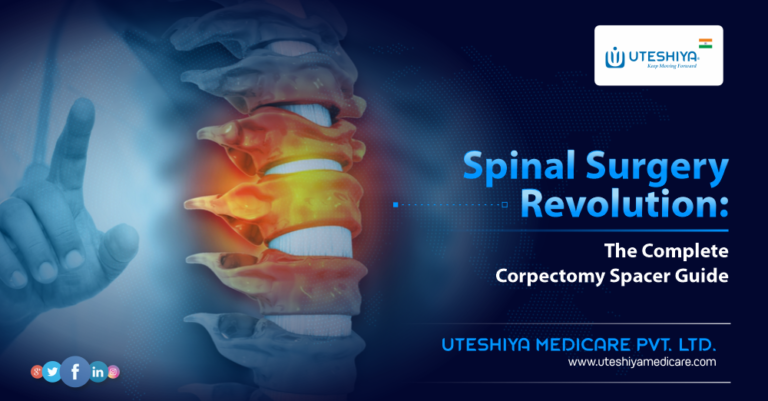 Spinal Surgery Revolution: The Complete Corpectomy Spacer Guide ...