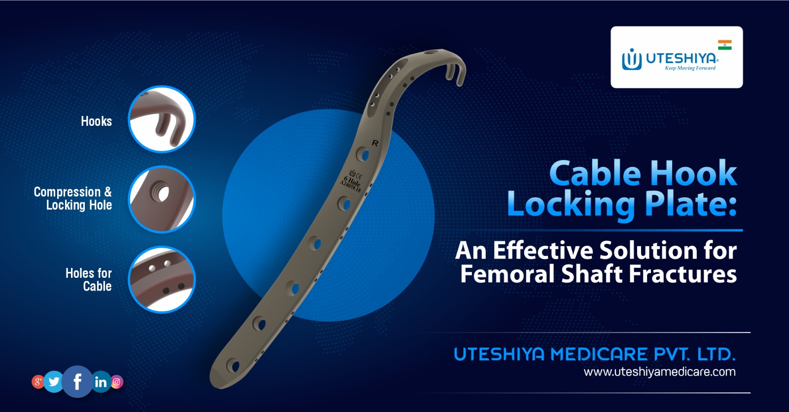 Cable Hook Locking Plate: An Effective Solution for Femoral Shaft ...