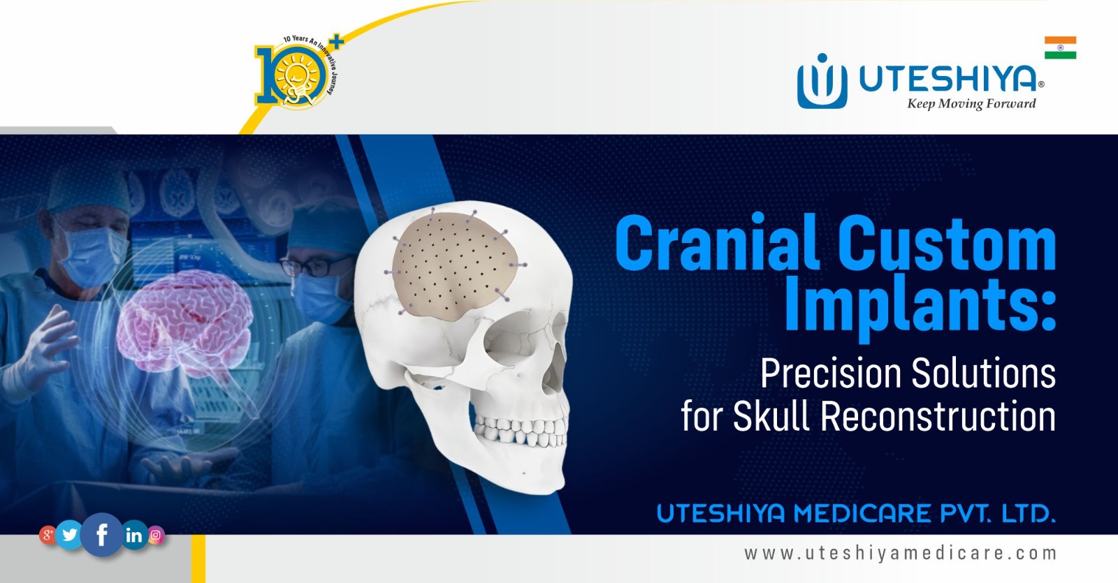 Cranial Custom Implants: Precision Solutions for Skull Reconstruction ...