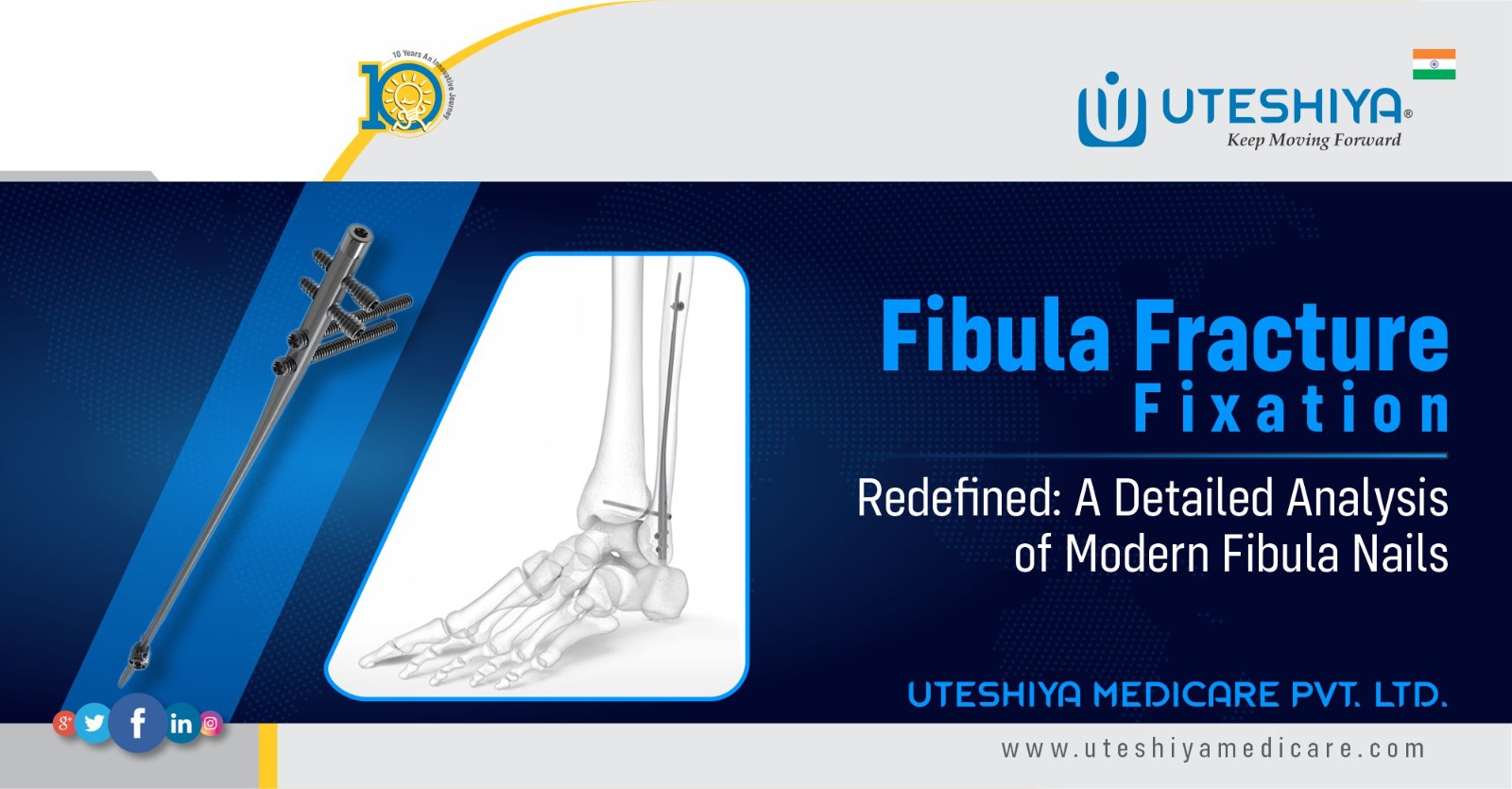 Fibula Fracture Fixation Redefined: A Detailed Analysis of Modern ...