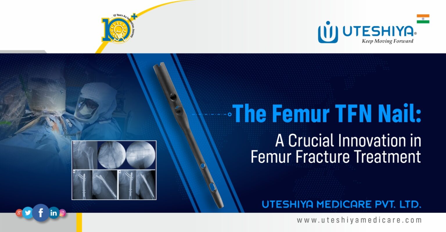 The Femur TFN Nail: A Crucial Innovation in Femur Fracture Treatment ...