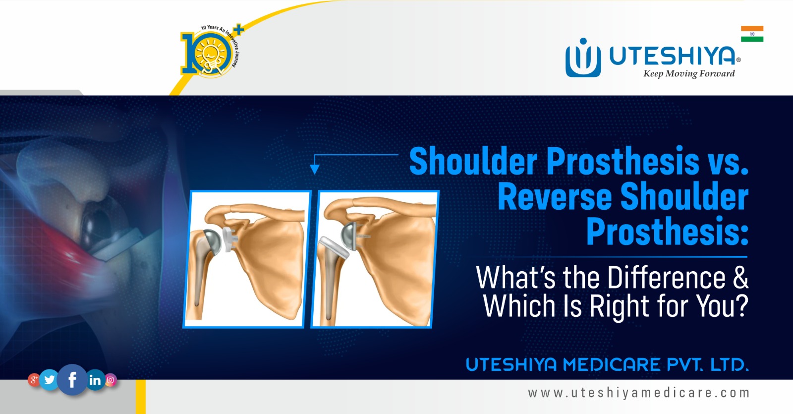 Shoulder prosthesis vs. Reverse shoulder prosthesis: What's the difference? Which one is best ...